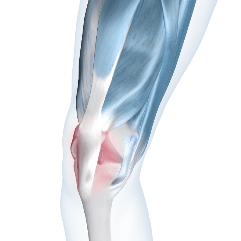 Symptoms & Treatment | Knee Pain While Running | Bauerfeind